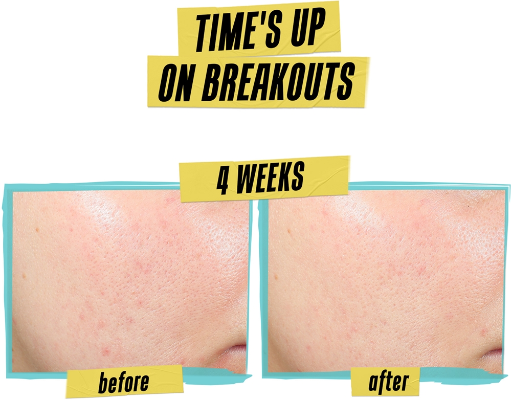 Kiehl's Dermatologist Solutions Expertly Clear Blemish-Treating ...