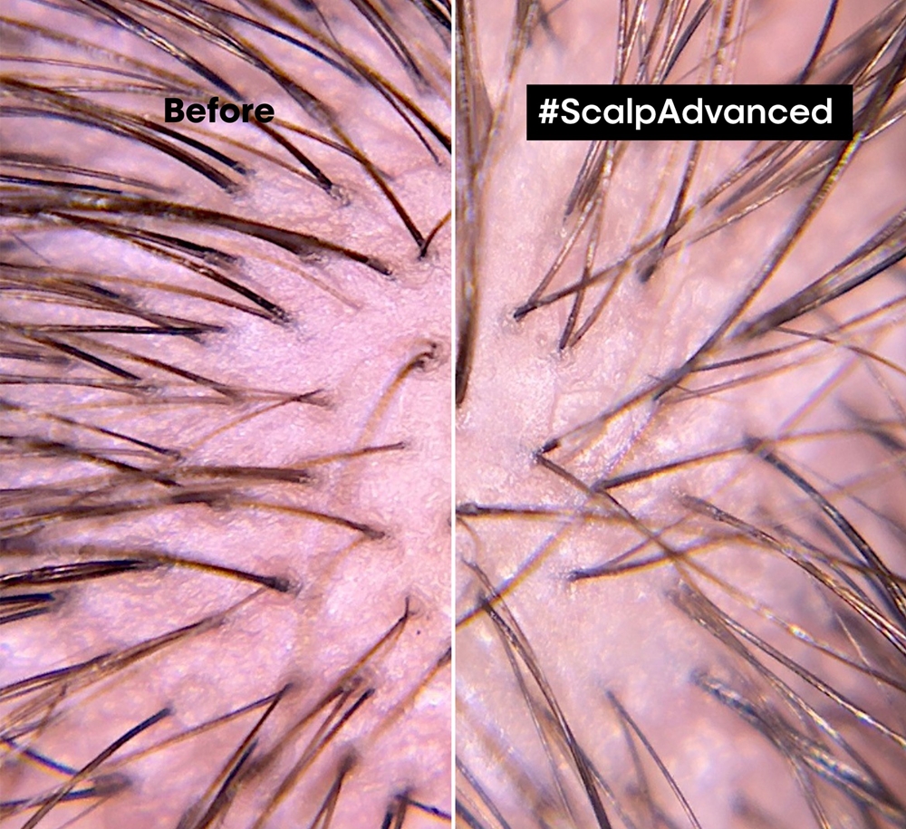 L’Oréal Professionnel Serie Expert Scalp Advanced Matu kopšana matiem ...