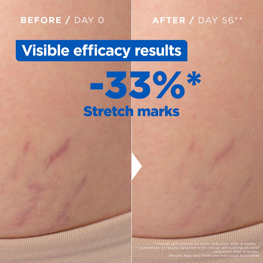 Mixa Stretch Mark Oil Olie tegen Striea | notino.nl