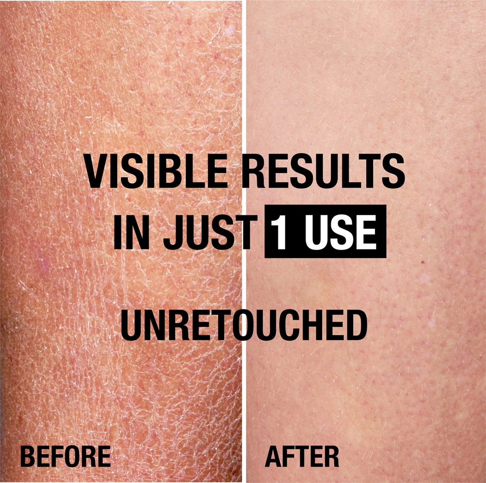 Neutrogena Intensive Hydration Care Gift Set for women | notino.ie