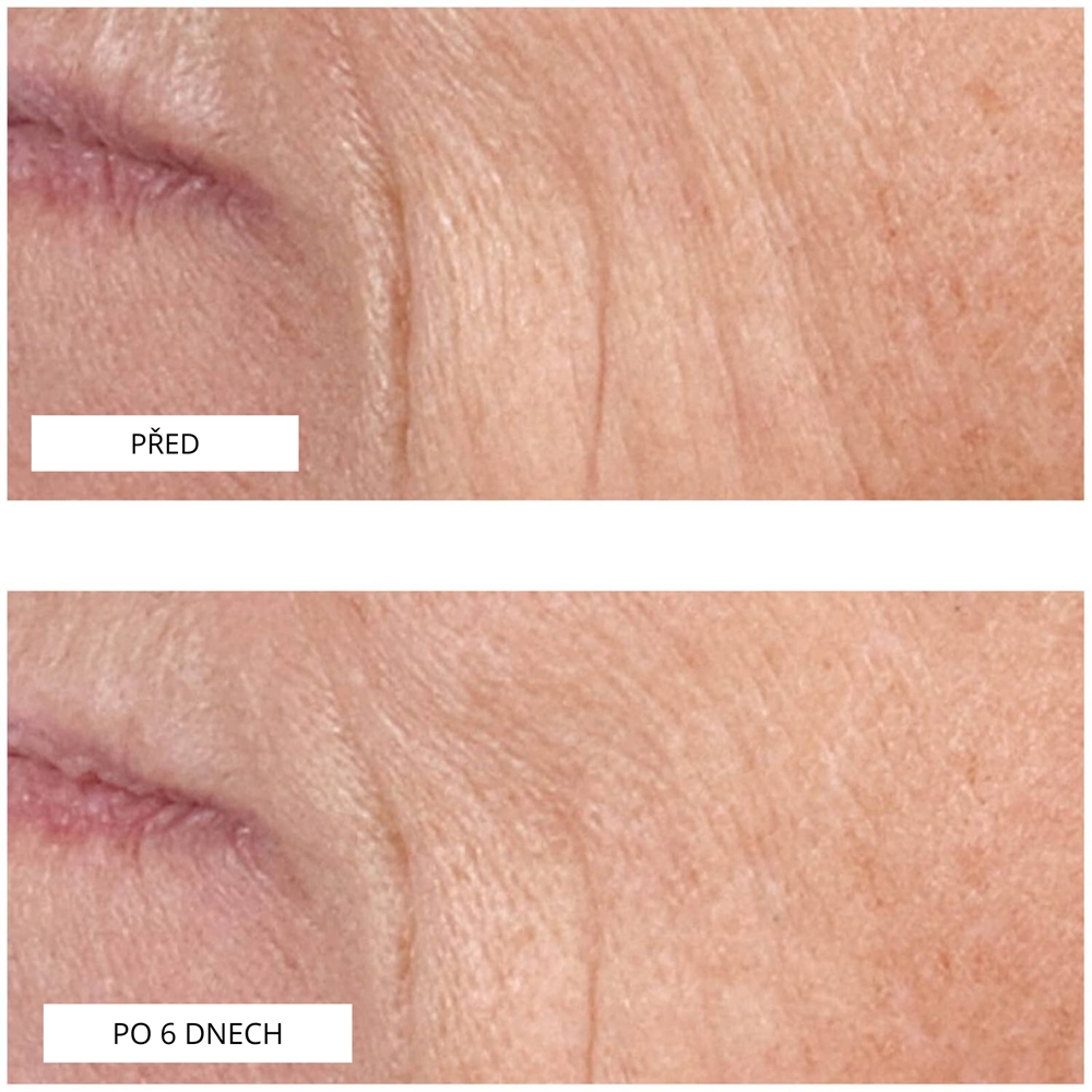 Perricone MD Cold Plasma Plus+ Treatment Sheet Mask | Brza dostava ...