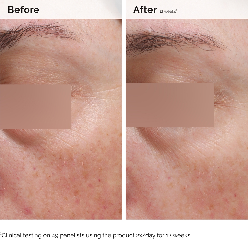 The Ordinary Niacinamide 5% Face & Body Emulsion émulsion légère ...