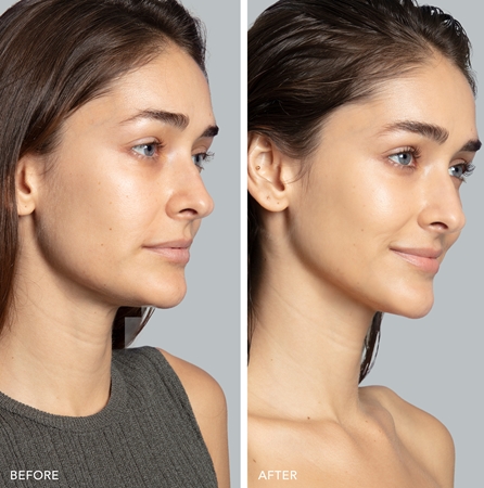 FOREO BEAR™ 2 mikroprúdový tonizačný prístroj na tvár | notino.sk