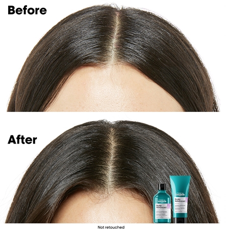 L’Oréal Professionnel Serie Expert Scalp Advanced shampoo for sensitive ...