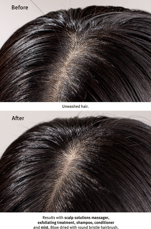 Aveda Scalp Solutions Exfoliating Scalp Treatment exfoliační gel pro ...
