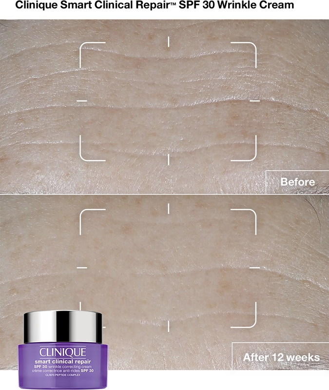 Clinique Smart Clinical™ Repair Wrinkle Correcting Cream SPF 30 anti ...