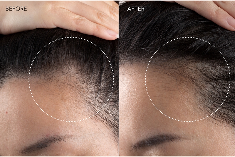 FOREO FAQ™ 301 masážní přístroj pro stimulaci růstu vlasů | notino.cz