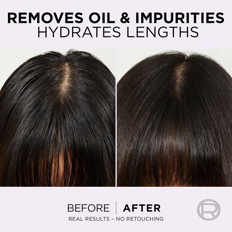 L’Oréal Paris Elseve Hyaluron Pure hair balm for oily scalp and dry ...