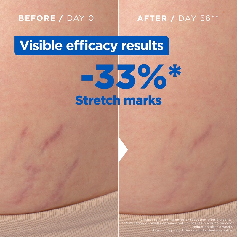 Mixa Stretch Mark Oil oil to treat stretch marks | notino.co.uk
